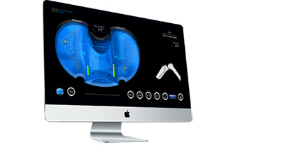 OrthoSensor, Intelligent Orthopedic Device Innovator - Today's Medical ...