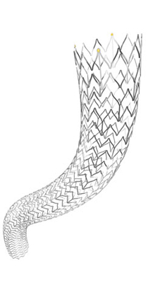 Cook Medical Launches Zilver Vena in Canada - Today's Medical Developments