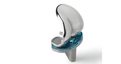 Marrying Zimmer Knee Systems with OrthoSensor's Verasense - Today's ...