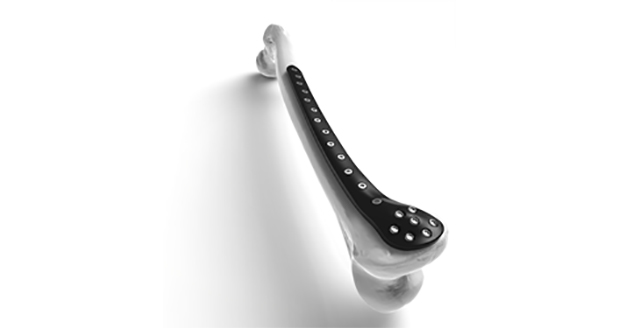 Trauma technology platform from Invibio - Today's Medical Developments