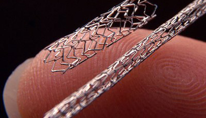 Doctors Overuse Stents, Despite Guidelines - Today's Medical Developments