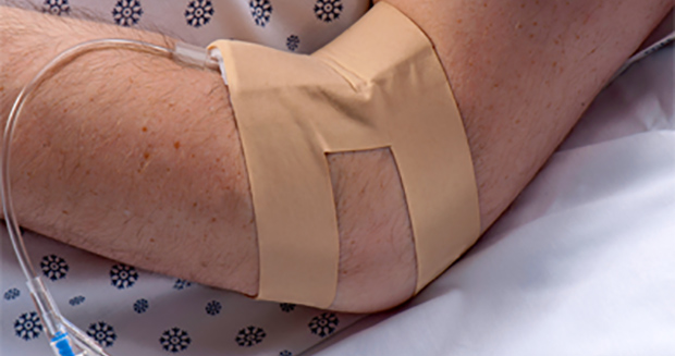 Solution to reducing problematic IV occlusions - Today's Medical ...