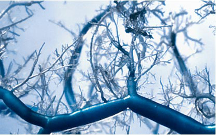 Chocolate PTA Cleared - Today's Medical Developments