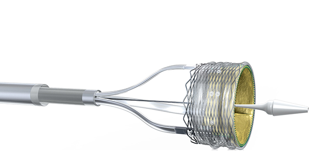 CE Mark for the new 25mm Lotus Valve System - Today's Medical Developments