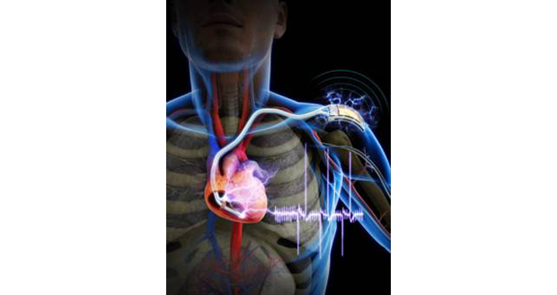 Self-powered cardiac pacemaker - Today's Medical Developments