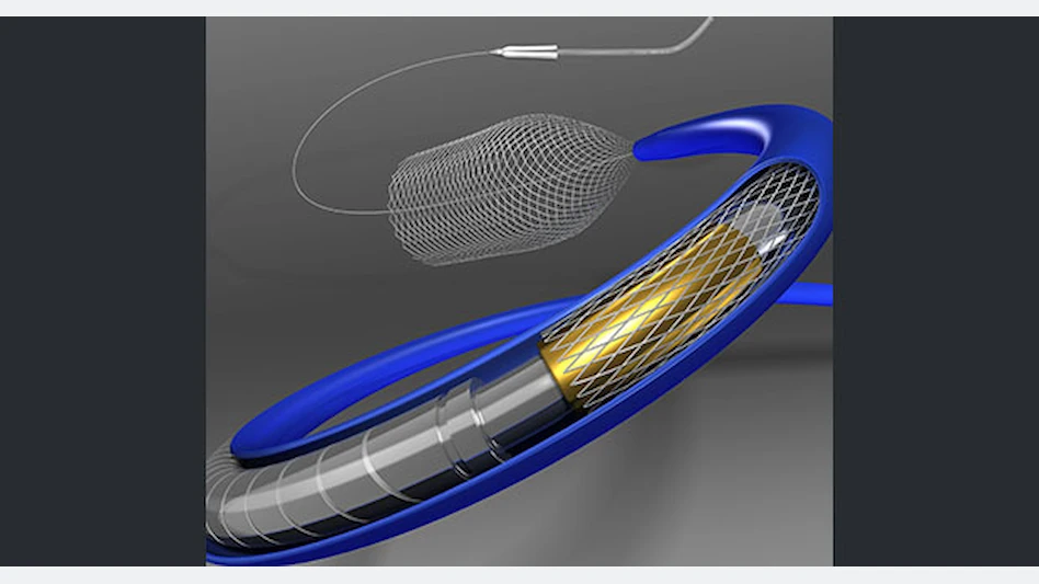 Medtronics Pipeline Flex Embolization Device Todays Medical Developments