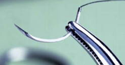 Antibacterial Coating for Sutures - Today's Medical Developments