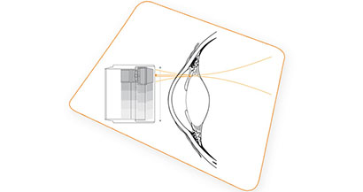 Compact Touch UBM - Today's Medical Developments