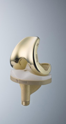 VEGA System PS Knee Replacement Technology Debuts - Today's Medical ...