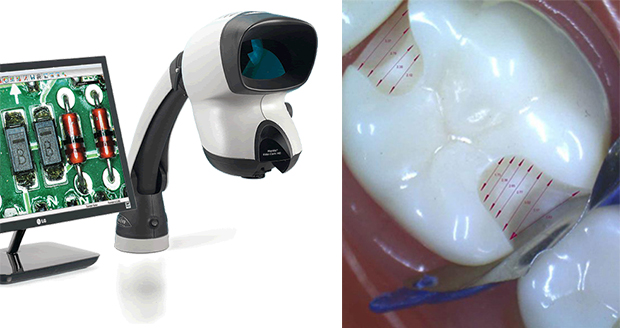 Vision Engineering’s Mantis Elite-Cam HD - Today's Medical Developments