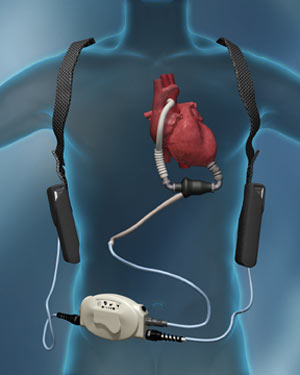 Elements of Motion - Today's Medical Developments