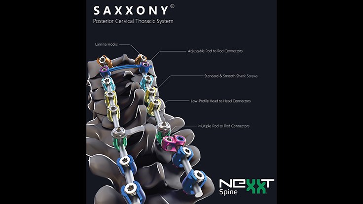 Nexxt Spine’s SAXXONY posterior cervical thoracic spine system - Today ...