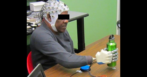 Brain-machine interface to control prosthetic hand - Today's Medical ...